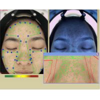 Quality Portable Skin Analyzer for sale