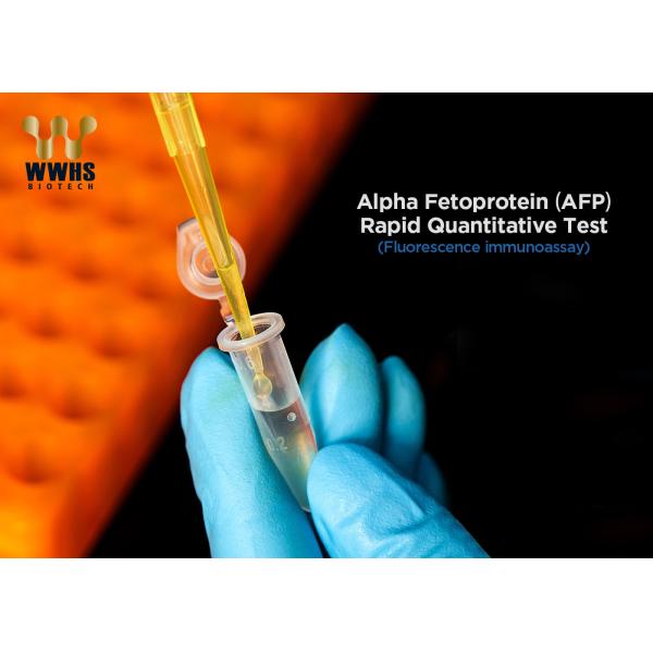 Quality CRP Rapid POCT Test Kit 3000 Tests/Day High Sensitivity 20T Package for sale