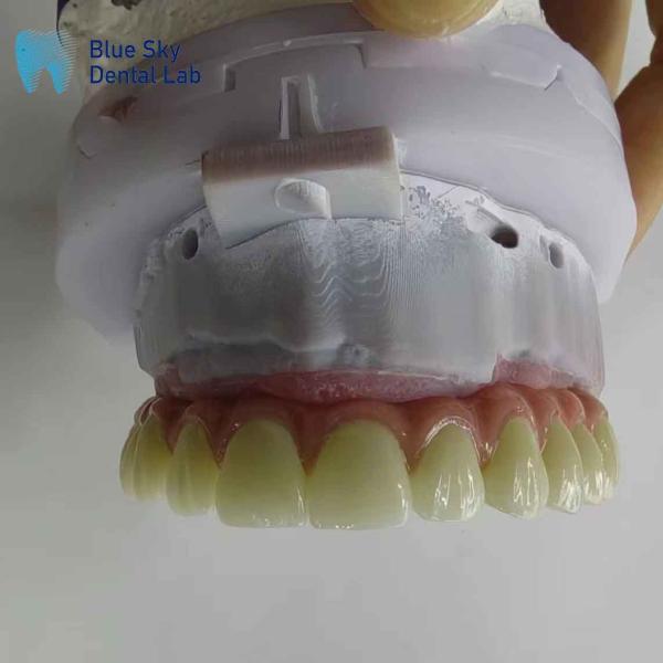 Quality Universal Compatibility Metal Malo Bridge With Pure Titanium Frame for sale