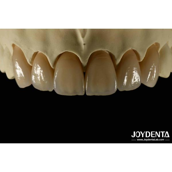 Quality Bionic Development Leaves And Distinct Layers Of Zirconia All-Ceramic for sale