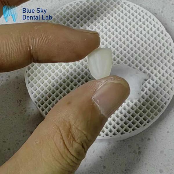 Quality 0.3mm Thin Glass Ceramic Veneer Implants Lightweight Veneer Cases for sale