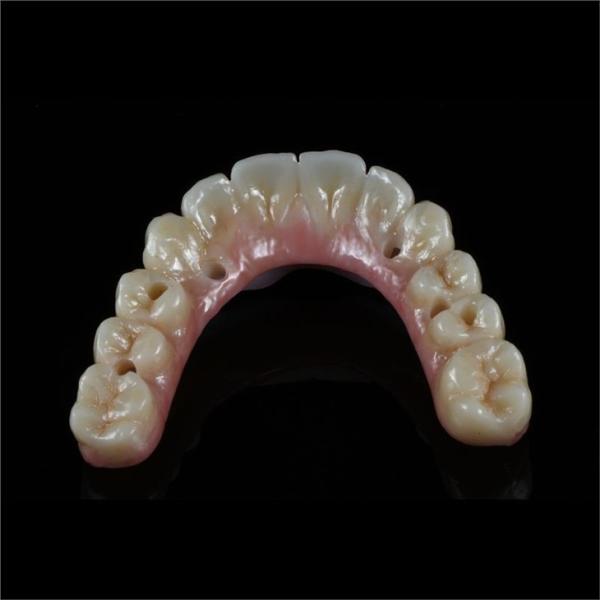 Quality Fixed Restorations Full Arch Zirconia Implant Bridge Denture Teeth for sale