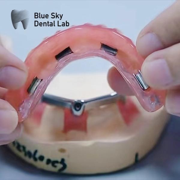 Quality Precision Dental Titanium Bar With Precious Attachment Biocompatible for sale