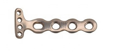 Quality Medical Lateral Volar Locking Plate Distal Radius Orthopedic Surgery Instrument for sale
