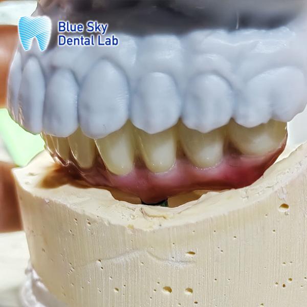 Quality Nature Surface Universal Compatible Multiple Choices Implant operation cases for for sale
