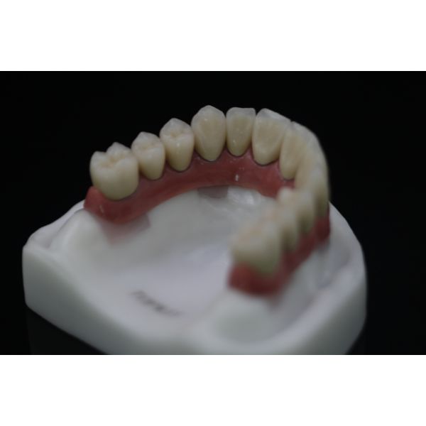 Quality Porcelain Dental Crown Tooth-Shaped Cap for Restoring Shape and Enhancing for sale