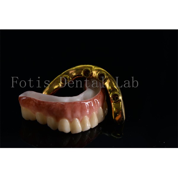 Quality Affordable All On Six Dental Implants Effective Treatment Easy To Clean for sale