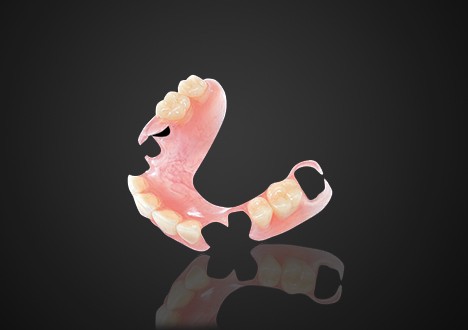 Valplast denture