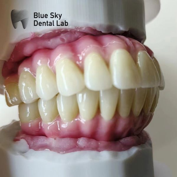 Quality Universal Customized Malo Bridge With Silver / Gold Anodized And Pure Titanium for sale