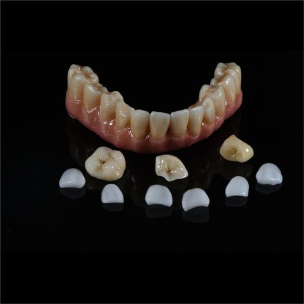 Quality Fixed Restorations Full Arch Zirconia Implant Bridge Denture Teeth for sale