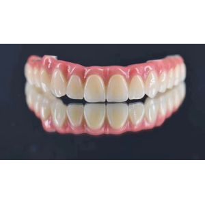 Quality Dental Lab Customized Implant Supported Metal Crown Natural Looking For Long for sale