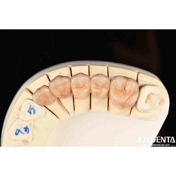 Quality Bionic Teeth Layered Zirconia with Bionic Leaf Micro-Engraving and Multi-color for sale