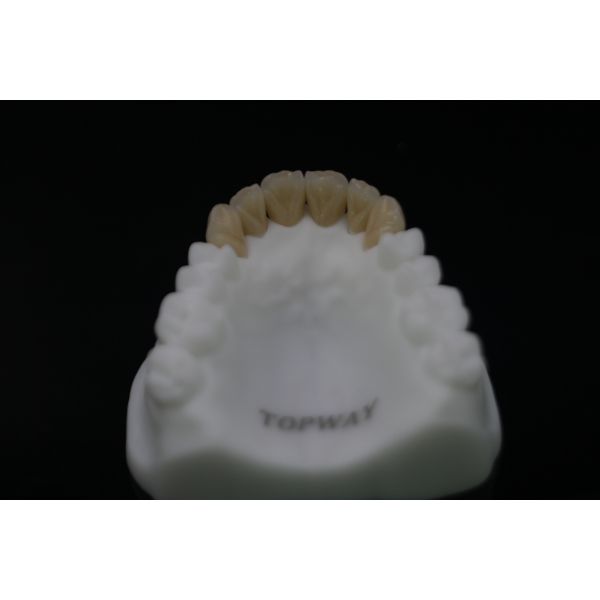 Quality Porcelain Dental Crown Tooth-Shaped Cap for Restoring Shape and Enhancing for sale