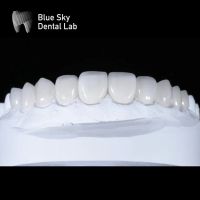 Quality Sleek Premium Veneer Cases 0.3mm Ultra Thin Emax Veneers for sale