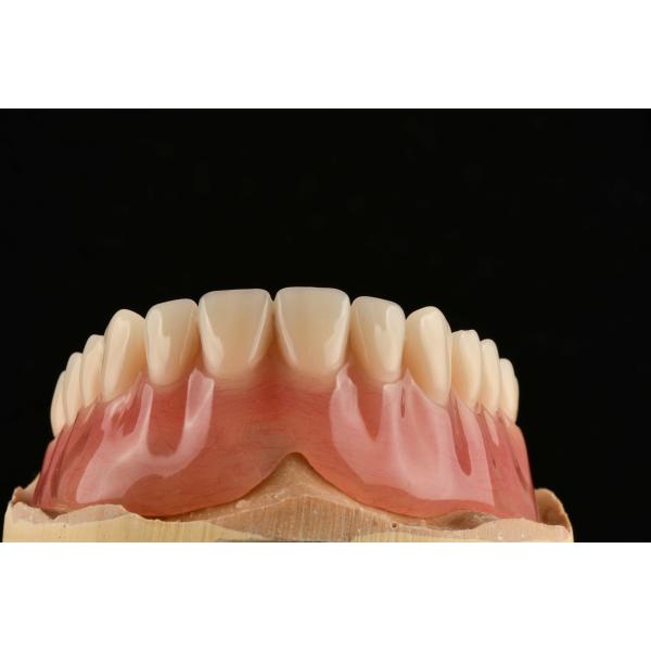 Quality Comfortable Clear Adjustable Removable Partial Denture That Resemble Natural for sale