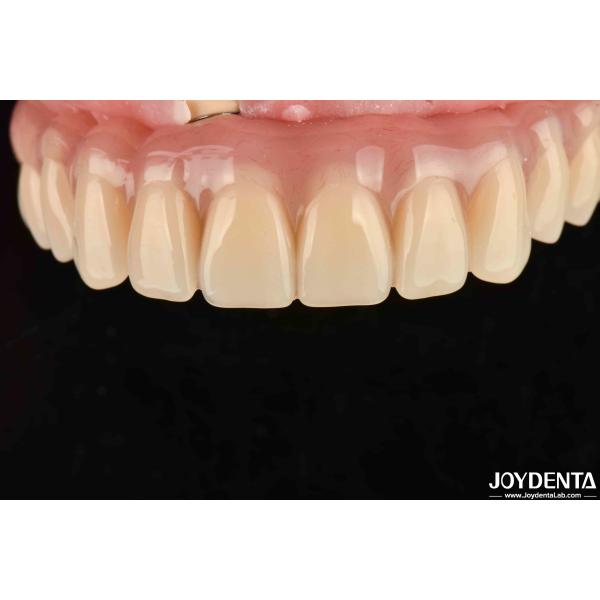 Quality Fast Drying 5 Minutes Acrylic Teeth Finish For Dental Tooth Restoration for sale