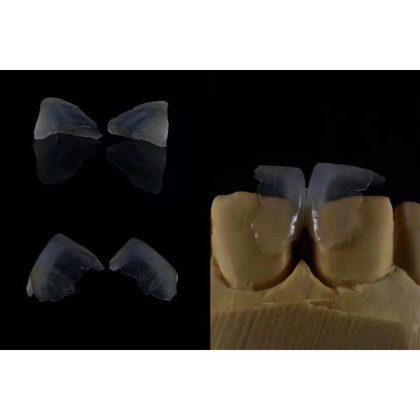 Quality Comfortable Dental Veneers Strong Bond With Tooth Enamel For Secure Fit Lightweight And Smooth For Optimal Patient Comfort for sale