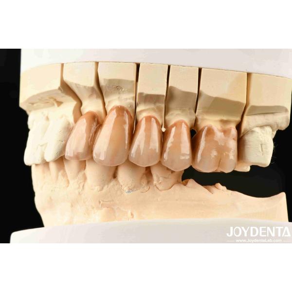 Quality Bionic Teeth Layered Zirconia with Bionic Leaf Micro-Engraving and Multi-color for sale