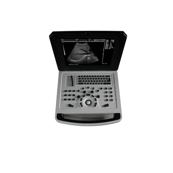 Quality Notebook Black And White Ultrasound Scanner for Cardiology for sale