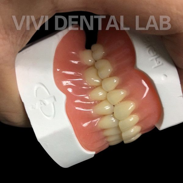 Quality Heat Cured Ivoclar Full Acrylic Denture Dental Lab High Accuracy for sale