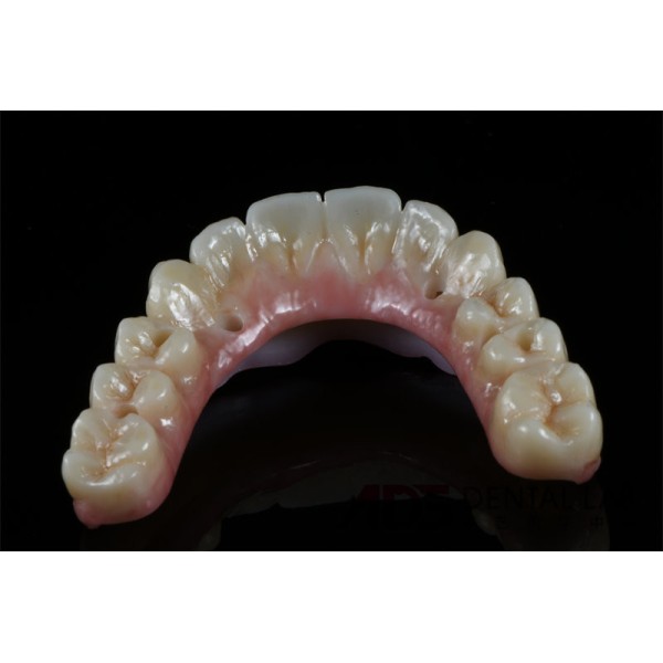 Quality All On 6 Zirconia Dental Implant Supported Bridge Full Arch Custom for sale