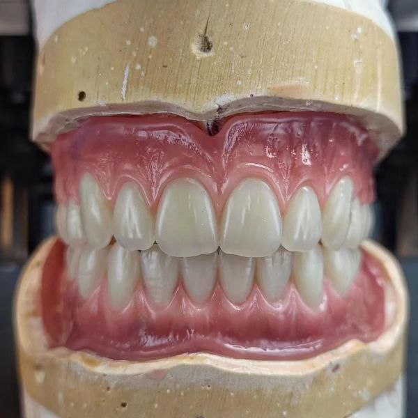 Full Acrylic Denture - Skelete Chrome Metal Partial Denture Printed ...