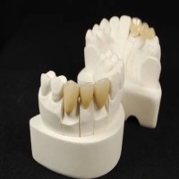 Quality Co-Cr Crown Cobalt-Chromium Dental Crown with High Durability Biocompatible and for sale