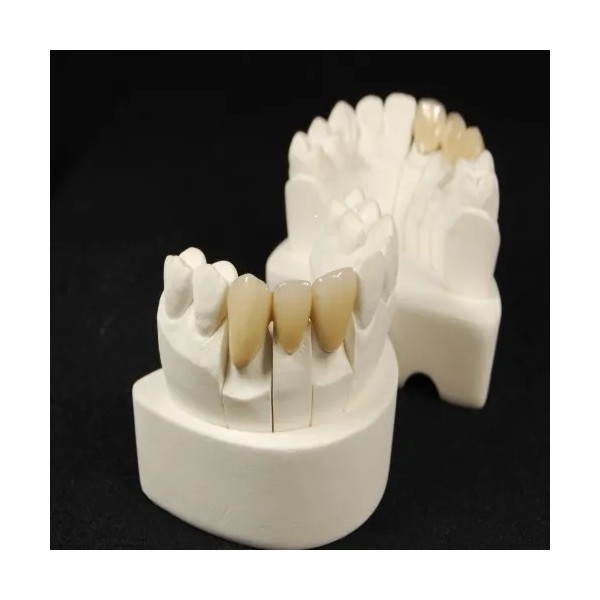 Quality Co-Cr Crown Cobalt-Chromium Dental Crown with High Durability Biocompatible and Corrosion Resistant for Molars and Premolars for sale