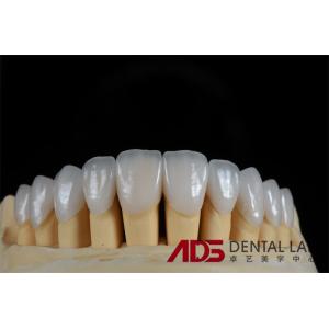 Quality Feldspathic Porcelain Laminate Dental Veneer Seamless Customized for sale