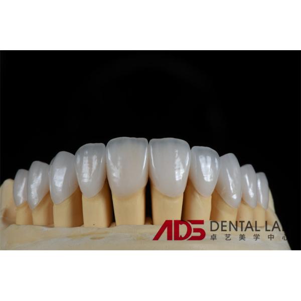 Quality Feldspathic Porcelain Laminate Dental Veneer Seamless Customized for sale