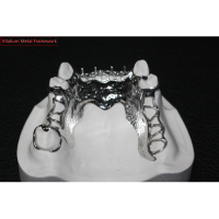 Quality Titanium Alloy Metal Framework for Removable Dentures - Lightweight and High for sale