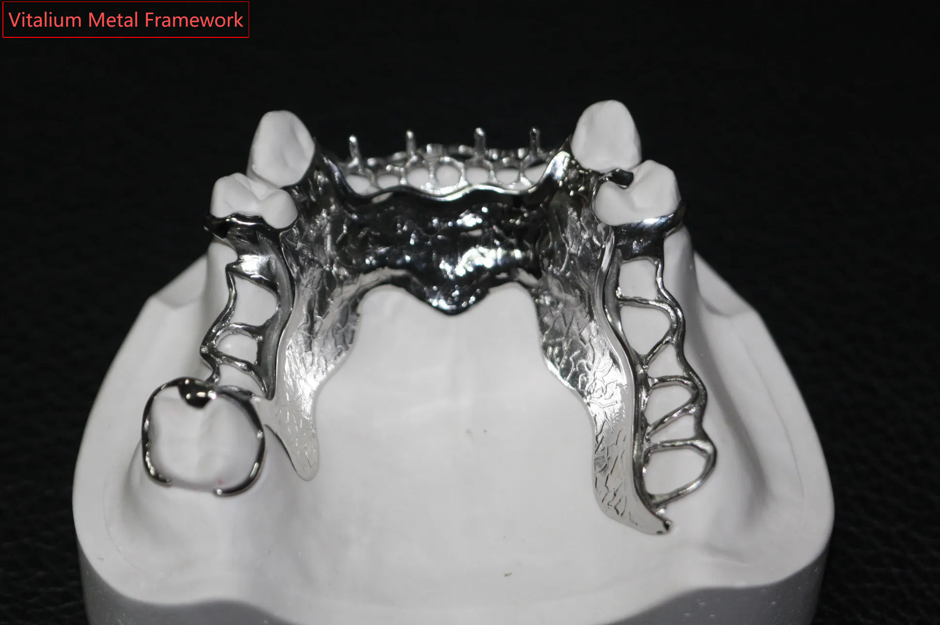 Quality Titanium Alloy Metal Framework for Removable Dentures - Lightweight and High for sale