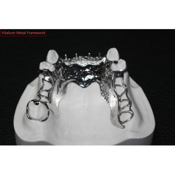 Quality Titanium Alloy Metal Framework for Removable Dentures - Lightweight and High Corrosion Resistance for sale