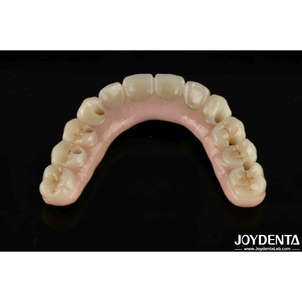 Quality High Durability Zirconia Ultimate Solution For Natural Teeth And Gums Compatibil for sale