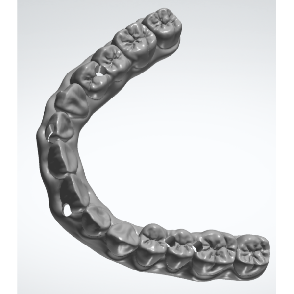 Quality Digital Aluminum Bar with Temporary Teeth for Dental Study Models for sale