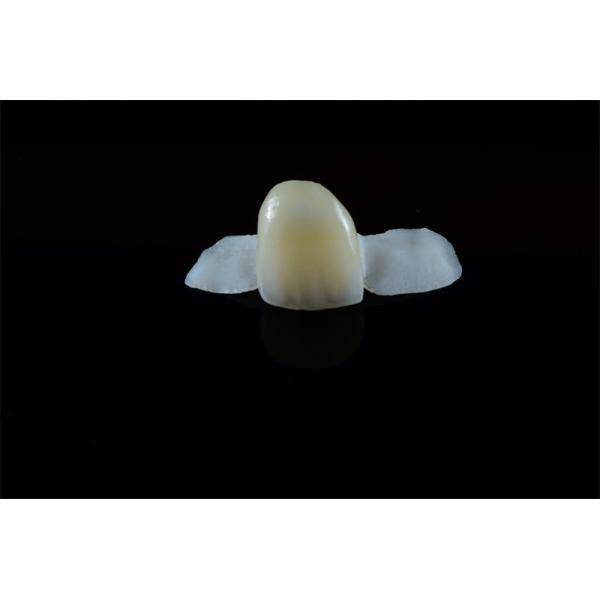 Quality Customized Dental Resin-bonded Maryland bridge for sale