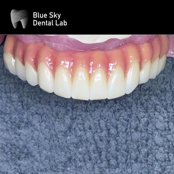 Quality Universal Autoclavable Rectangular Implant Cases Smooth Surface Silver Color for sale