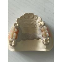 Quality Customized Dental PEEK Acrylic Partial Denture Adjustable With Secure Fit for sale