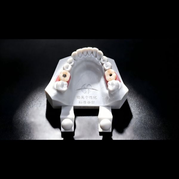 Quality Non Precious PFM Crown Implant Porcelain Fused To Metal Crown for sale