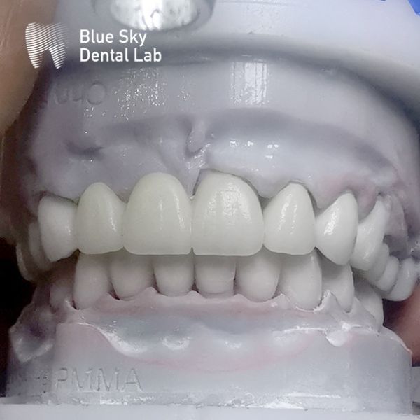 Quality Rectangular Layered Zirconia Teeth Multilayer Before Glazing for sale