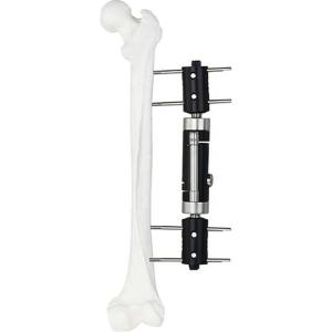 Quality Orthopedic Medical Implant Straight Type External Fixator Ex Fix Device for sale