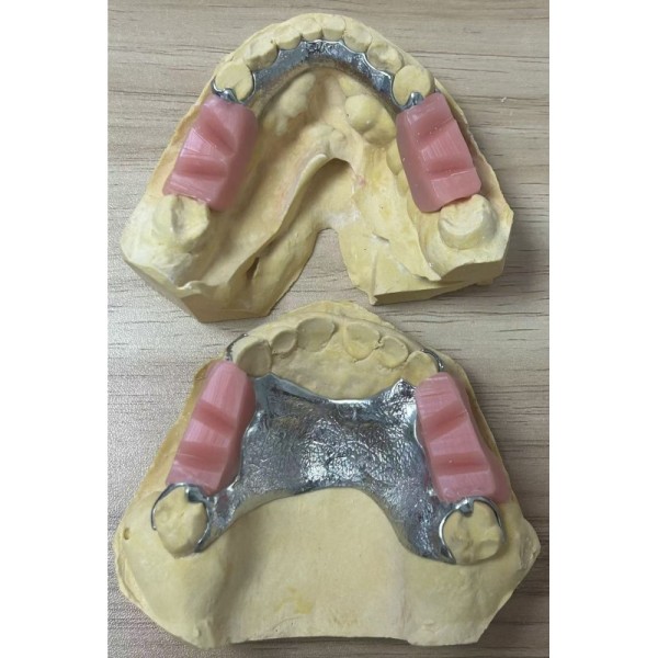 Quality Metal Framework with acrylic partial denture finish for sale