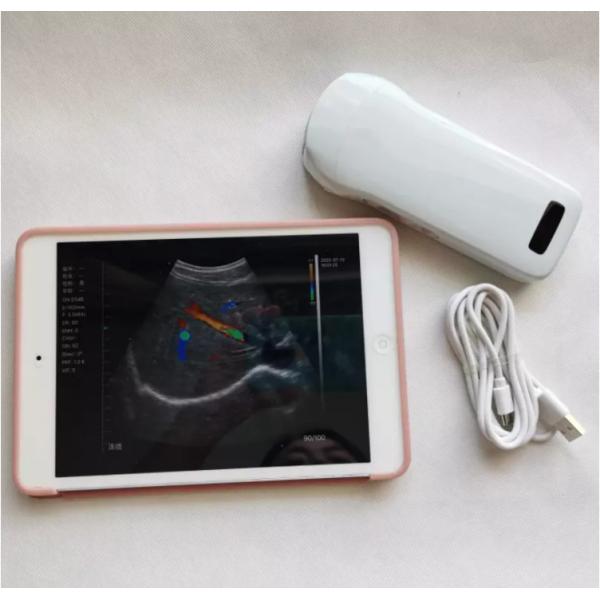 Quality GYN Ultrasound Instruments Wireless Portable Clinical Probe Analytical for sale