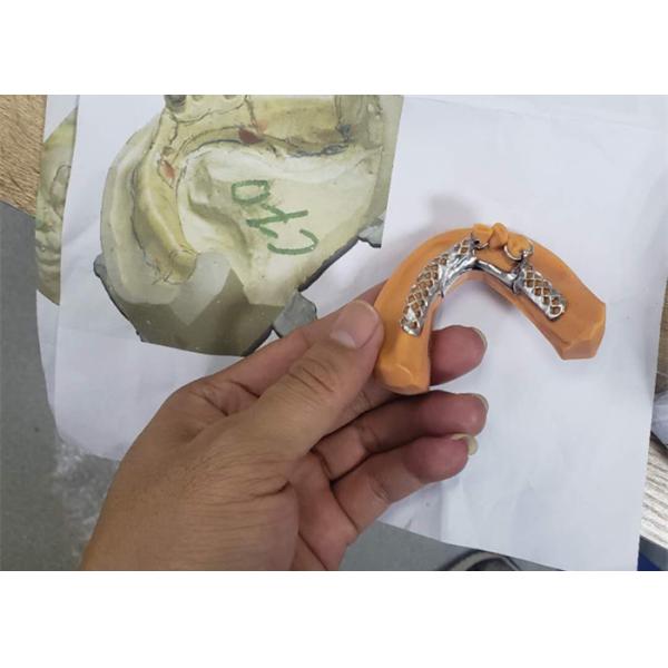 Quality Flexible Digital PFM Dental Crown Bridge Ultra Hard Easy Maintain for sale