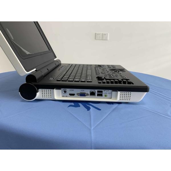 Quality OEM Hospital Ultrasonic Diagnostic Instrument 120GB Ultrasound Medical Equipment for sale
