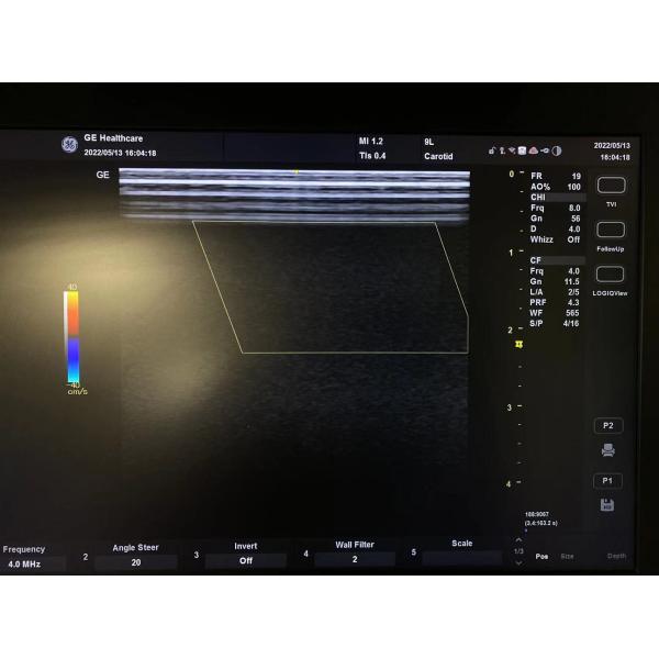 Quality GE VividE Original Linear Ultrasound Probe 9L-RS , GE Ultrasound Transducers 3.3-10.0 Mhz for sale