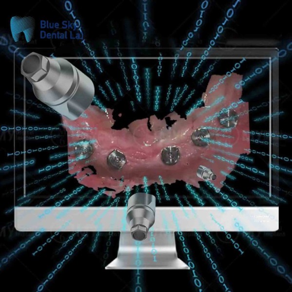 Quality Reusable Implant Direct Scan Body All In One Dental Scan Bodies for sale