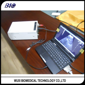 Small Portable Ultrasound Machine Probes With 2~11MHz Frequency 160g Weight Only