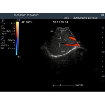 Quality Full Digital Color Dopple Machine Portable Diagnostic Color Ultrasound Scanner for sale