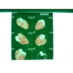 Quality Medical Digital X Ray Dry Film , Dt2b / Dt1b Agfa Medical Dry Imaging Film for sale
